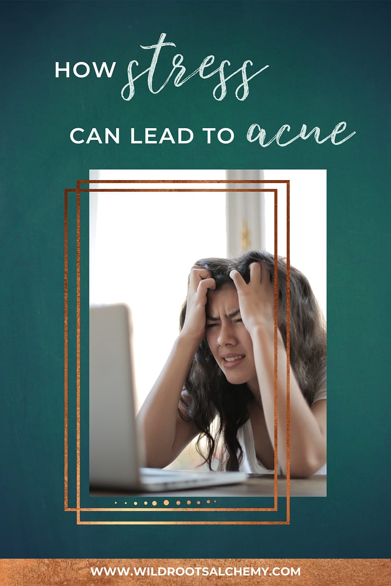 How Stress can Lead to Acne - Wild Roots Alchemy